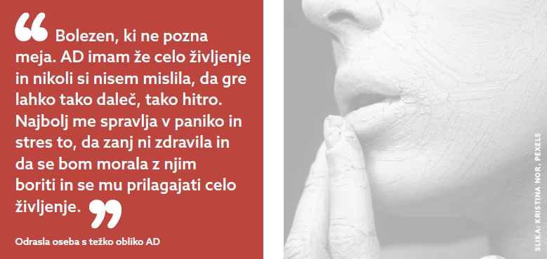 Kakovost življenja z atopijskim dermatitisom 2022 - Atopika